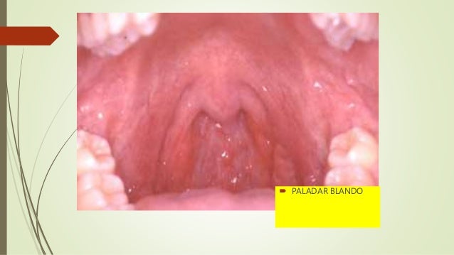 Exploración clínica de orofaringe