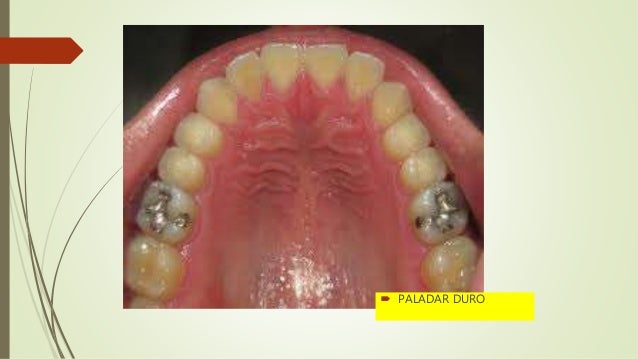 Exploración clínica de orofaringe