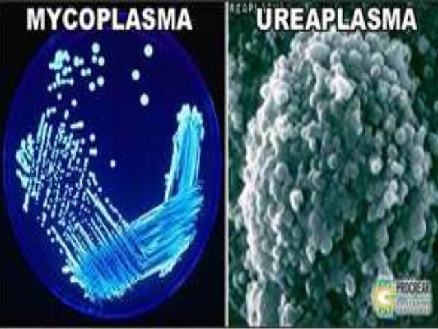 ITS por Mycoplasma e Ureaplasma