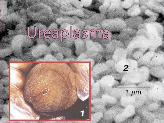 Its Por Mycoplasma E Ureaplasma
