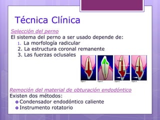 Endopostes e inflamacion y dolor | PPTX