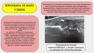 SONOGRAFIA musculoesqueletica | PPTX