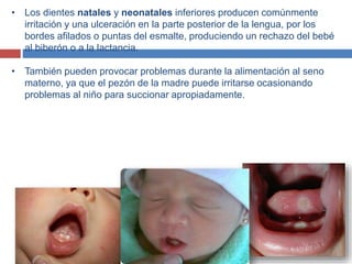 ALTERACIONES DEL DESARROLLO DENTAL EN RELACION AL NUMERO | PPTX