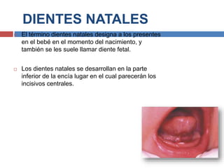 ALTERACIONES DEL DESARROLLO DENTAL EN RELACION AL NUMERO | PPTX