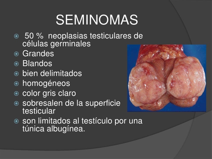 Expo Pato Testiculo[1]