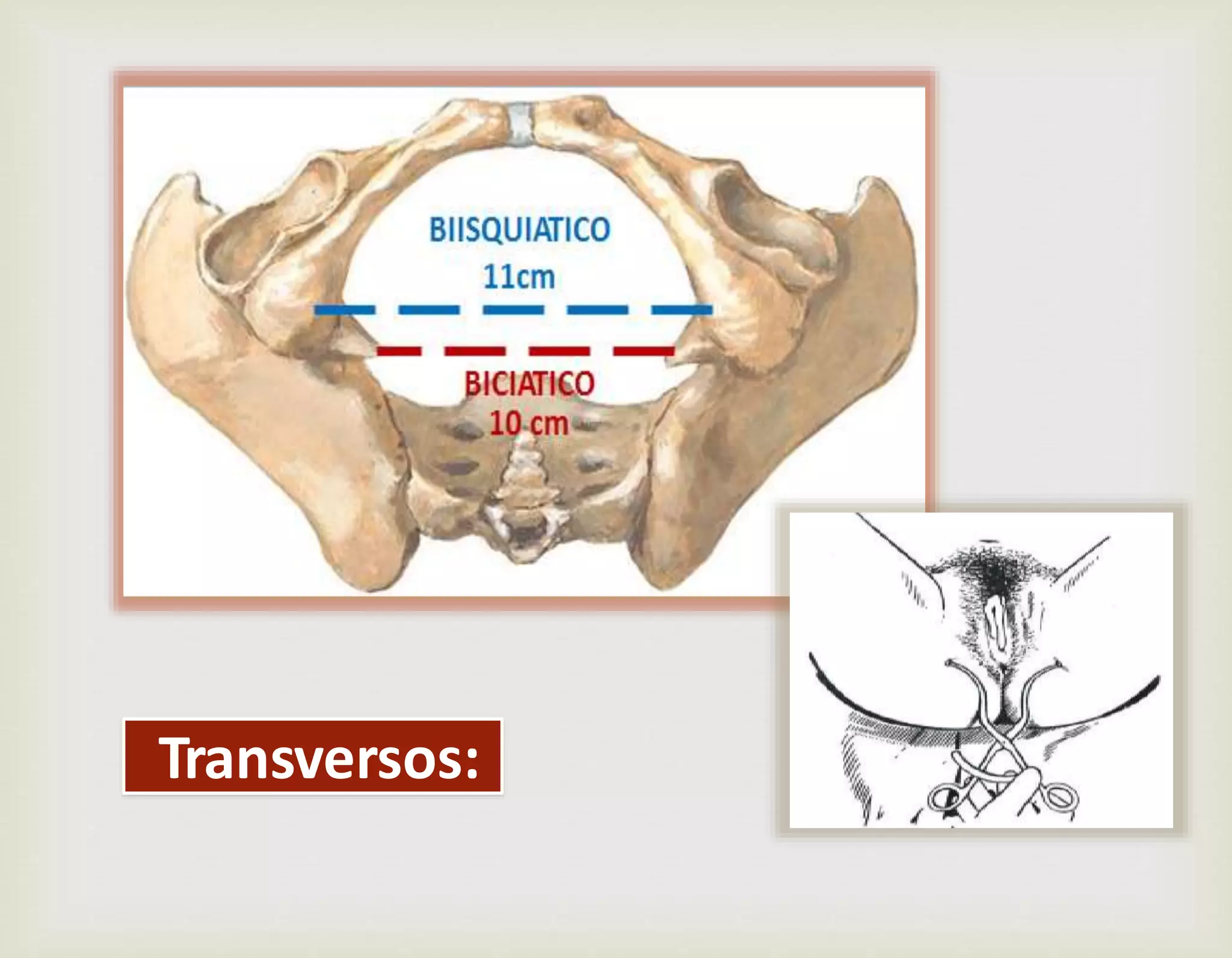 pelvis_pelvimetria_planos | PPTX