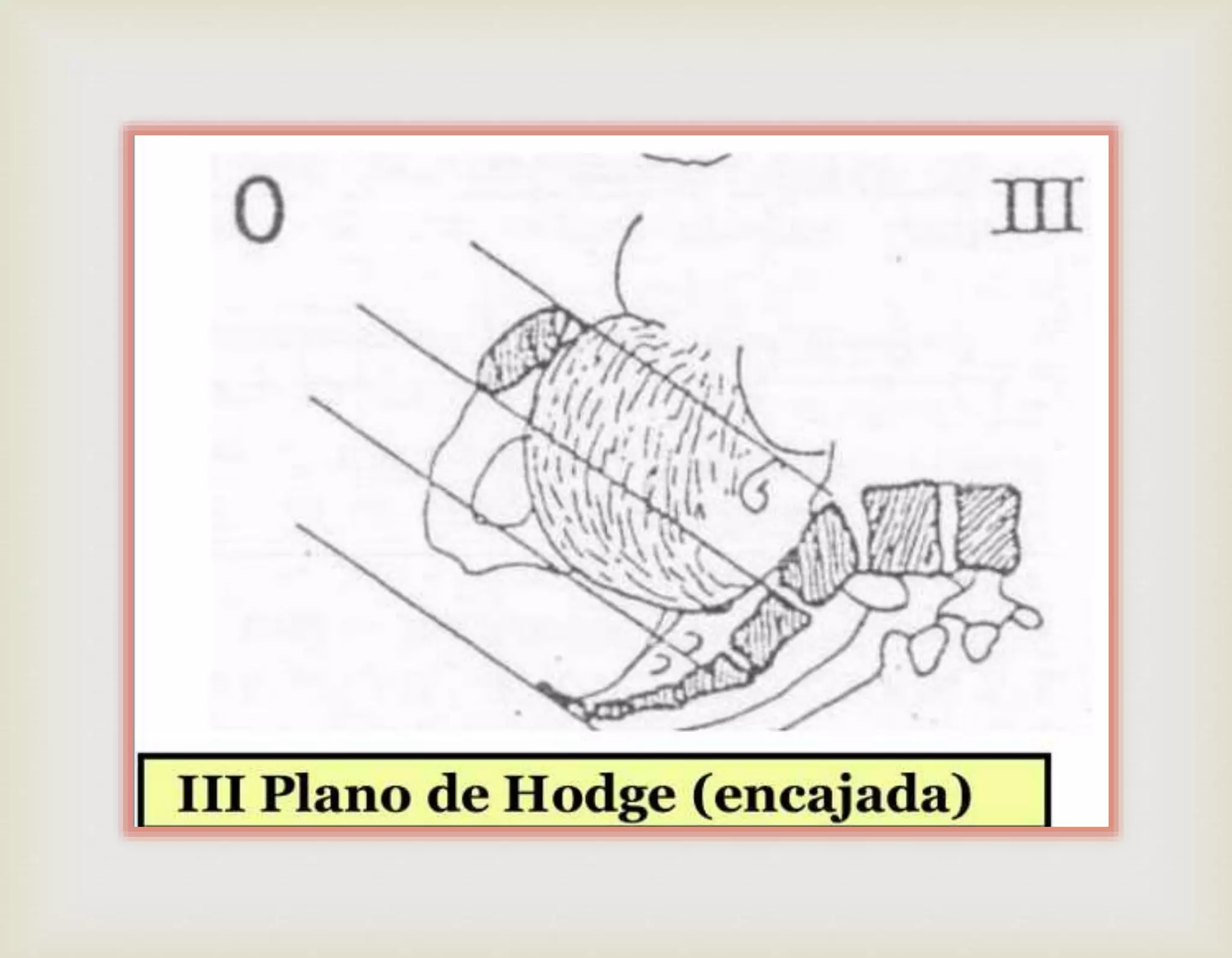 pelvis_pelvimetria_planos | PPTX