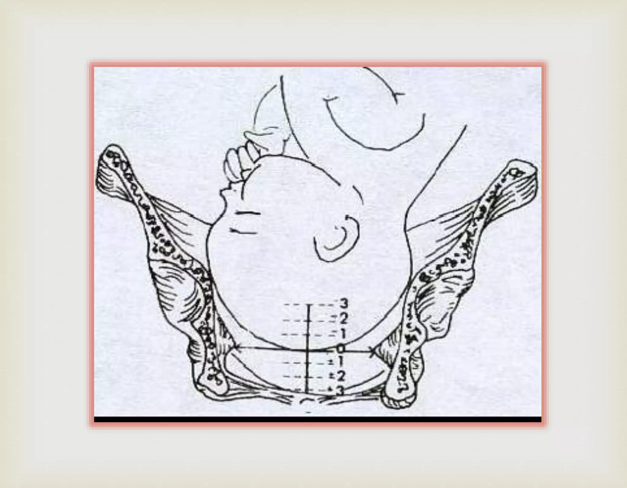 pelvis_pelvimetria_planos | PPTX