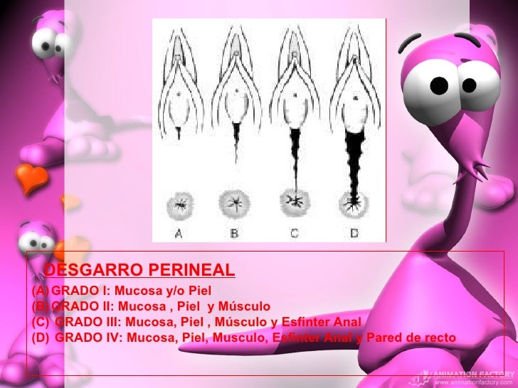 prolapso genital