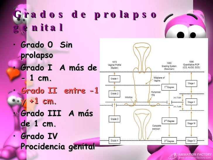 prolapso genital