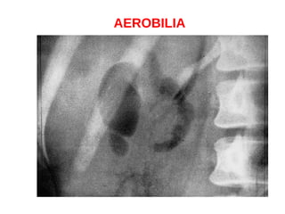 RADIOGRAFIA ABDOMINAL | PPT