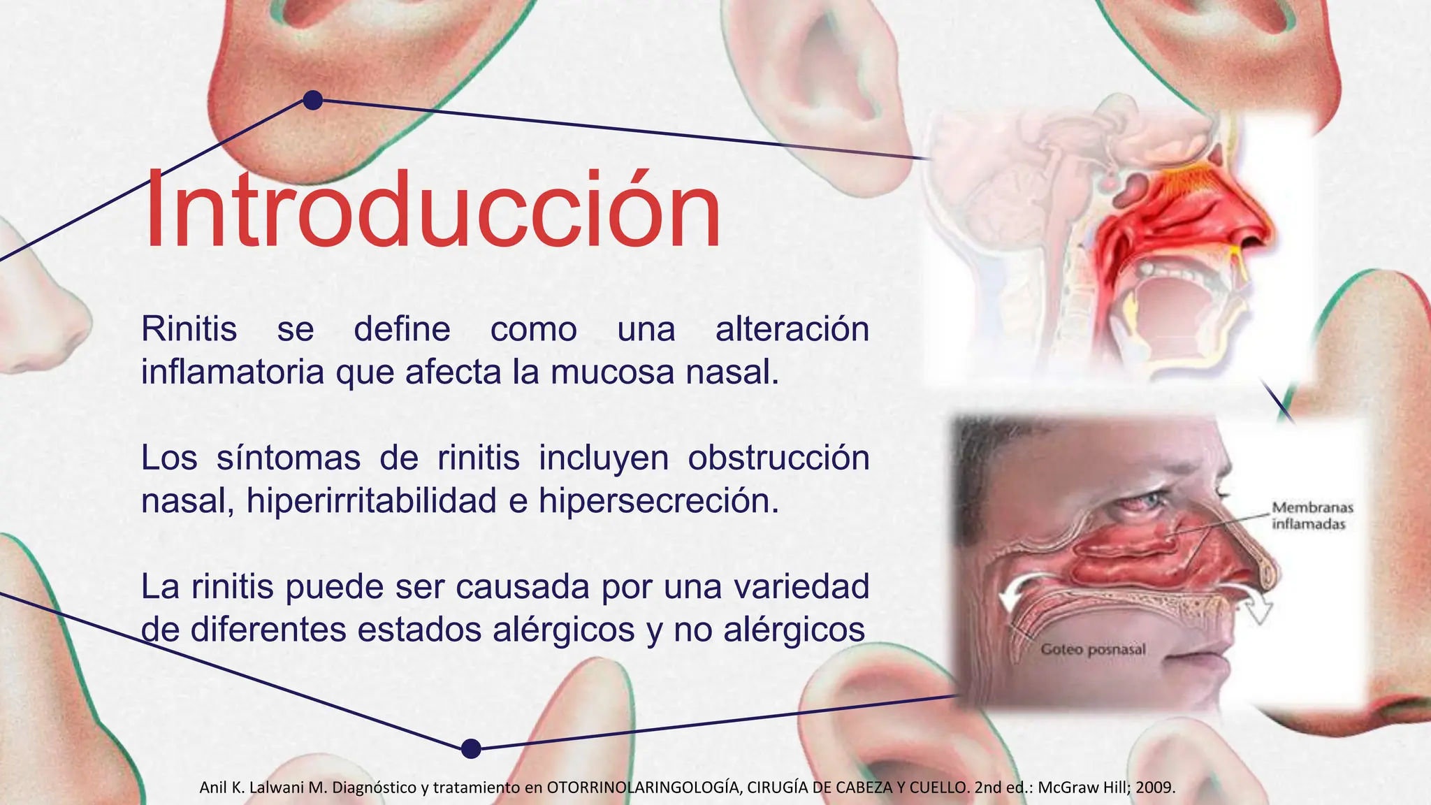 EXPO RINITIS en medicina general ...pptx