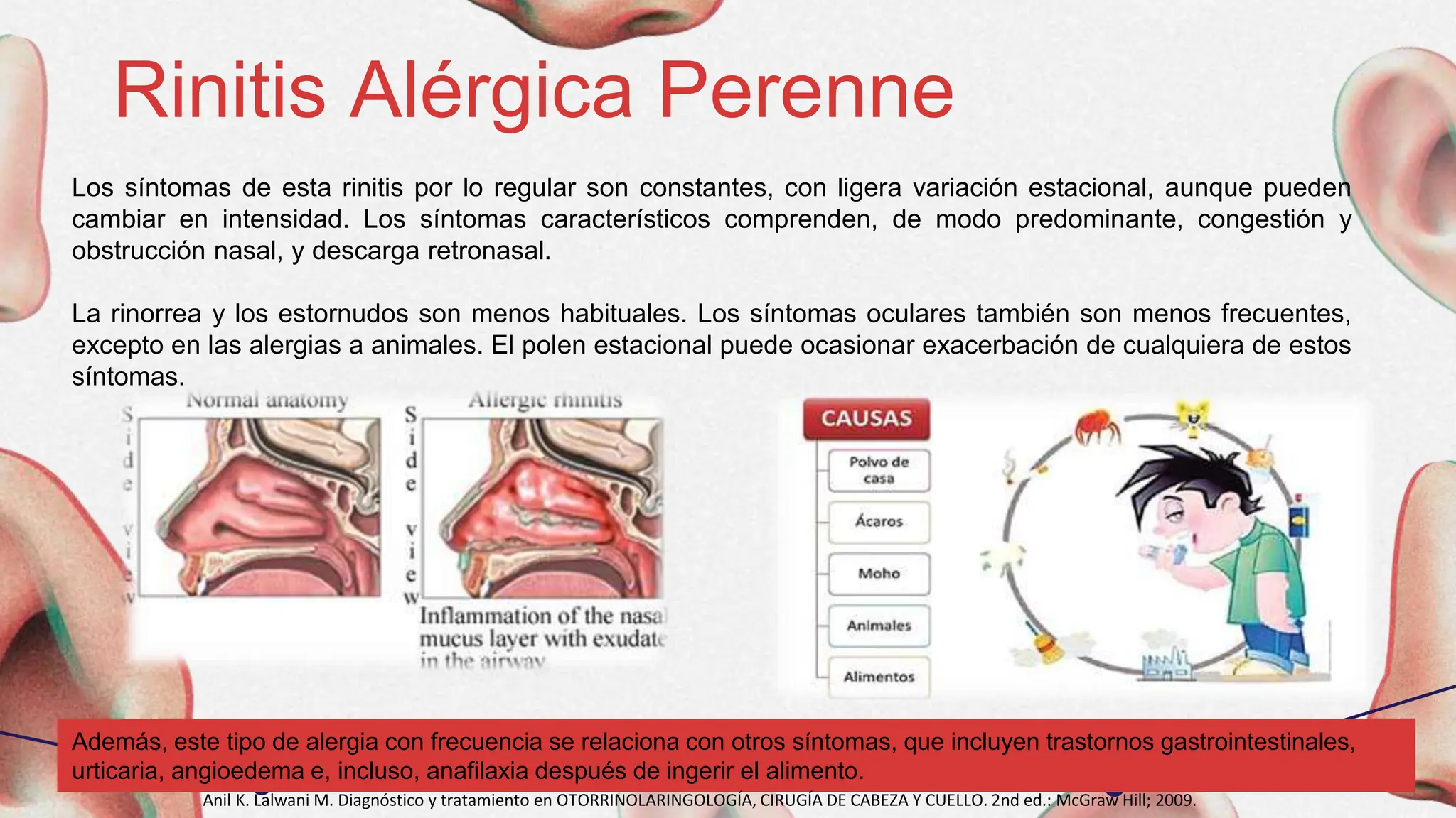 EXPO RINITIS en medicina general ...pptx