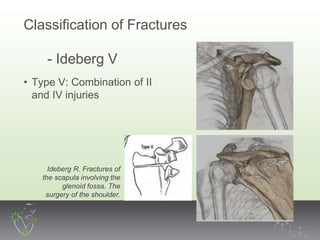 Scapula Fractures | PPTX