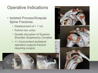Scapula Fractures | PPTX