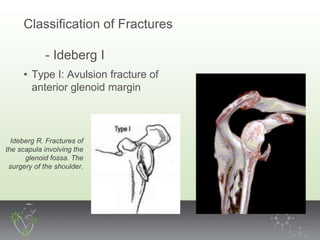 Scapula Fractures | PPTX