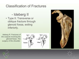 Scapula Fractures | PPTX