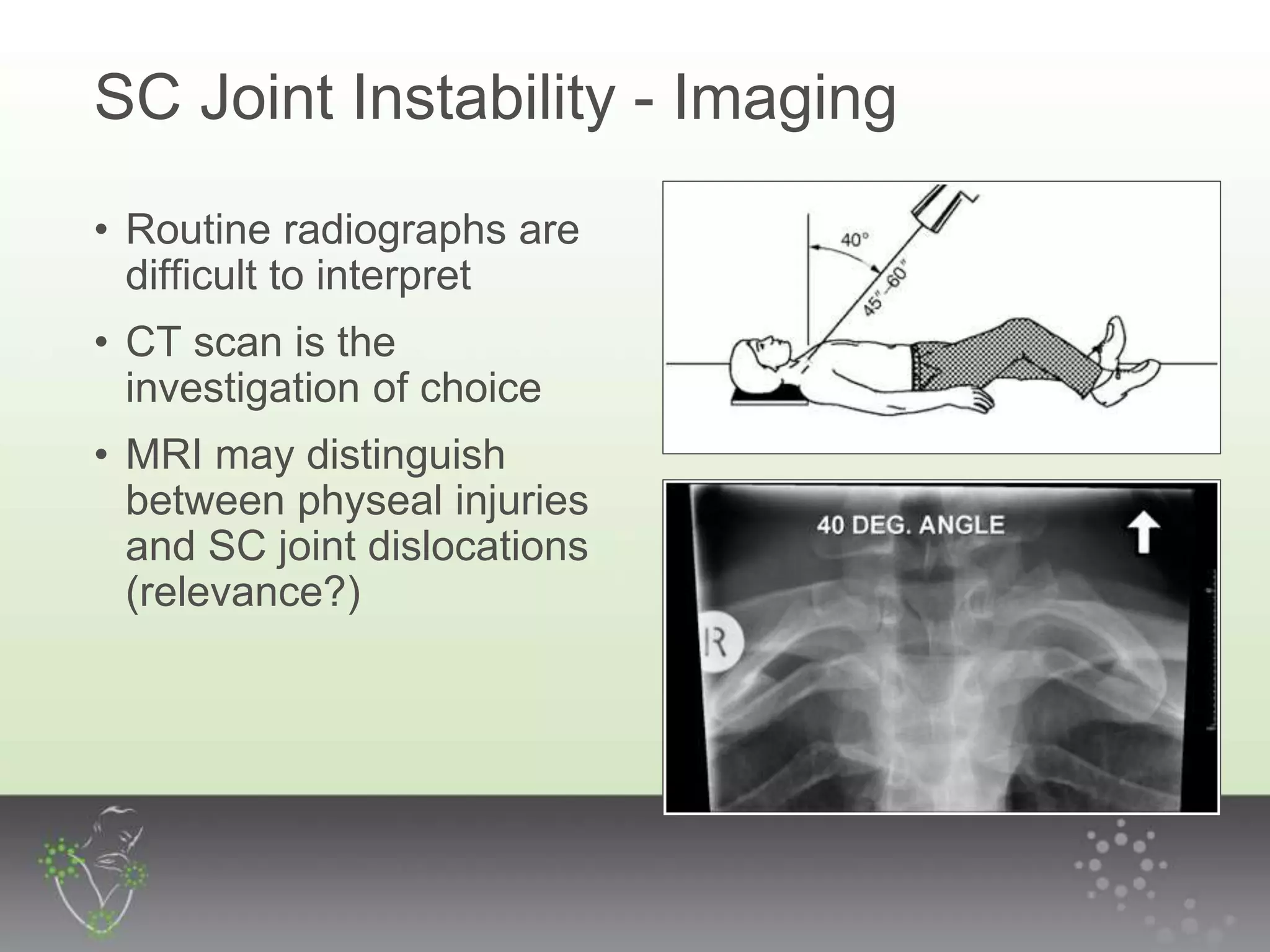 The Sternoclavicular Joint Ppt