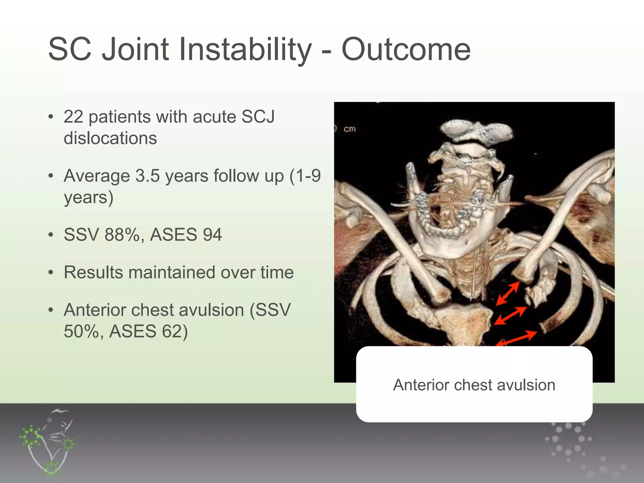The Sternoclavicular Joint | PPTX