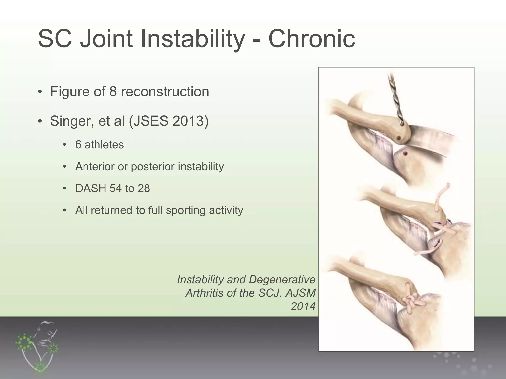 The Sternoclavicular Joint | PPTX