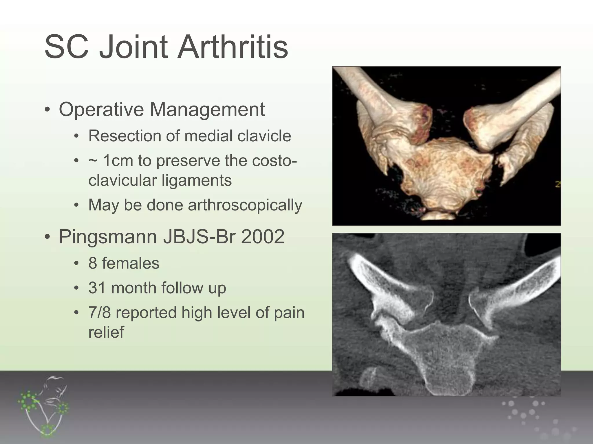 The Sternoclavicular Joint | PPTX