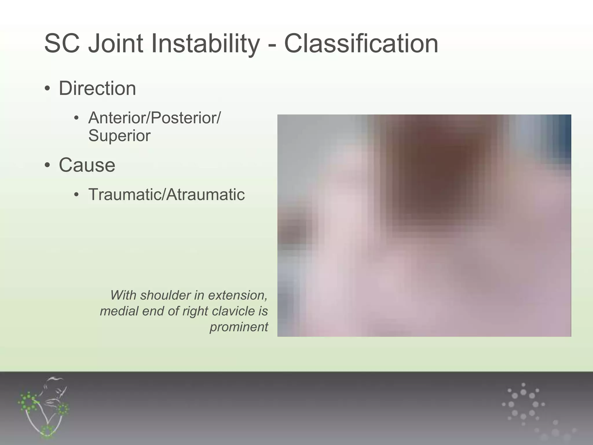 The Sternoclavicular Joint | PPTX
