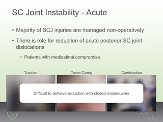 The Sternoclavicular Joint | PPTX