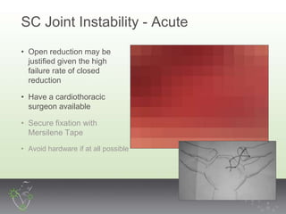 The Sternoclavicular Joint | PPTX