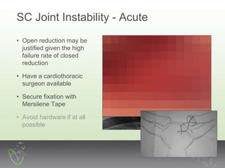 The Sternoclavicular Joint | PPTX