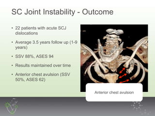 The Sternoclavicular Joint | PPTX