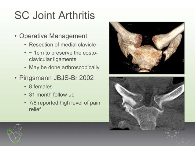 The Sternoclavicular Joint | PPTX