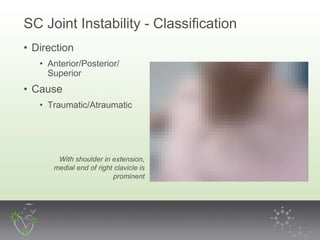 The Sternoclavicular Joint | PPTX