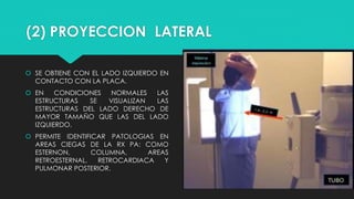 Radiografia de Torax | PPTX