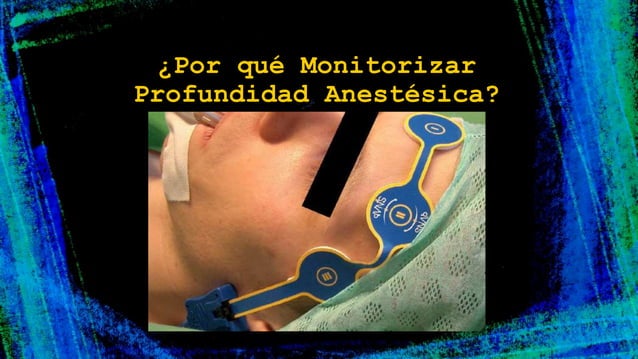 monitorizacion de profundidad anestesica bis , entropia