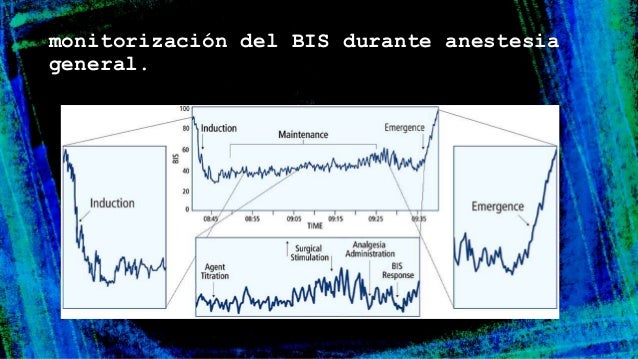 monitorizacion de profundidad anestesica bis , entropia