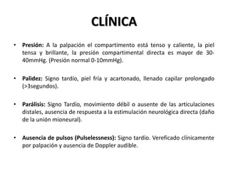Sindrome Compartimental | PDF
