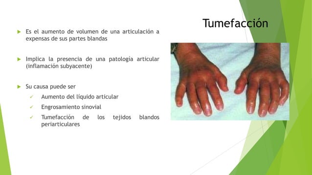 Síntomas y signos de la inflamación articular | PPT