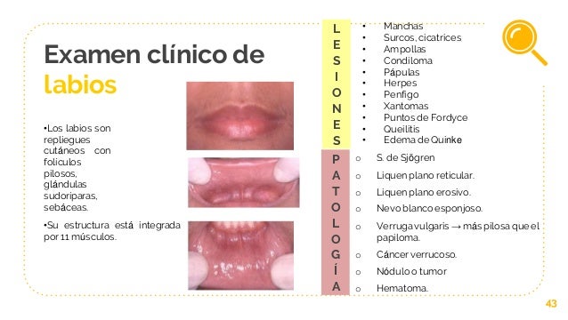 Expo semiologia de cabeza y cuellobn