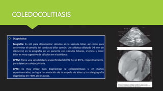 coledocolitiasis | PPTX