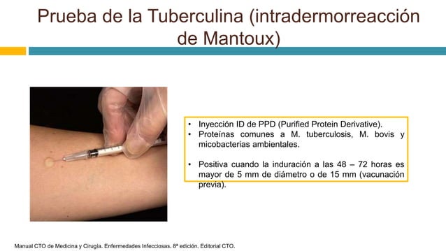 Exposición tuberculosis (1) | PPTX | Lung and Respiratory Health ...