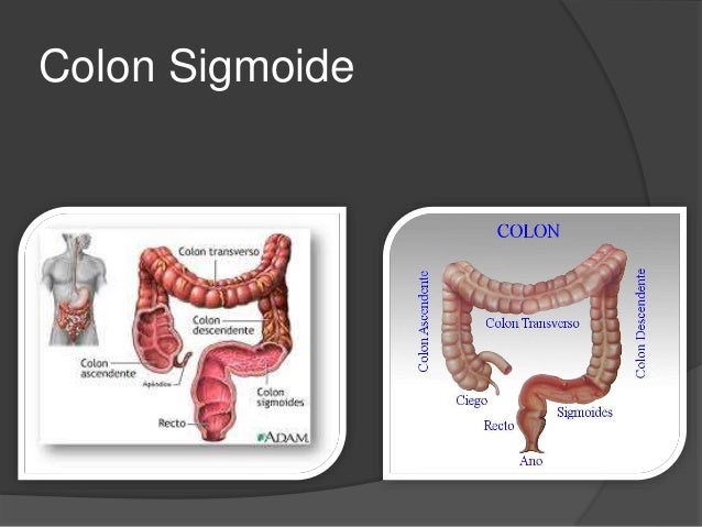 Exposición colon y volvulo sigmoide