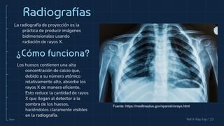 Exposición de Rayos X.pptx