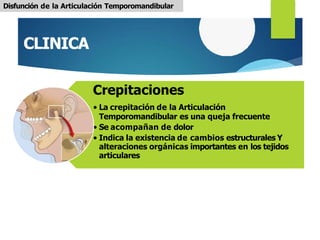 Disfuncion ATM | PDF