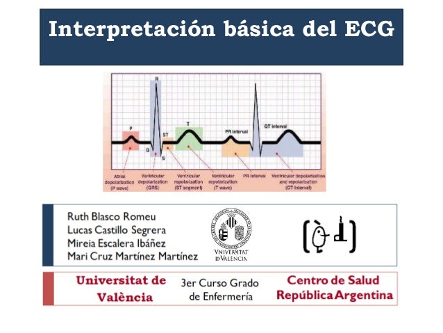 Interpretacion Electrocardiograma Ekg