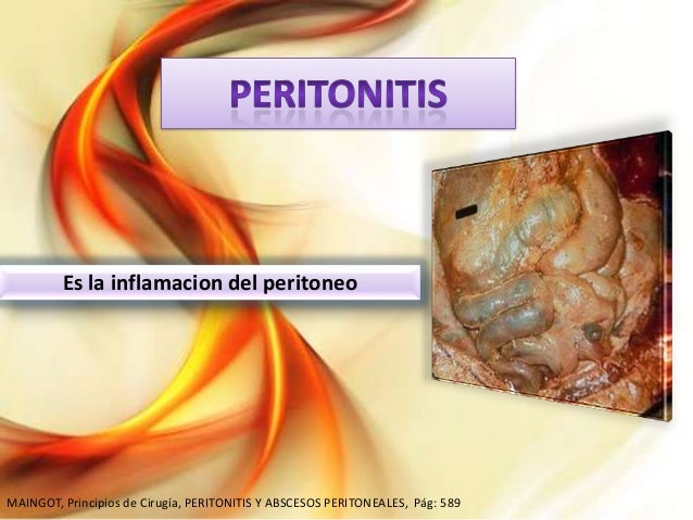 Anatomía de peritoneo y Peritonitis