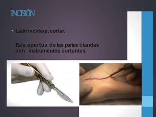 exposicion-incisiones-quirurgicas.pptx