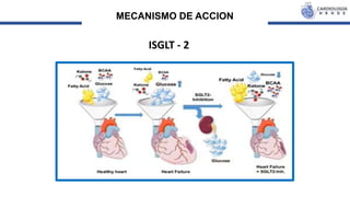 EXPOSICION - ISGLT 2 - REVISION ACTUALIZADA.pptx