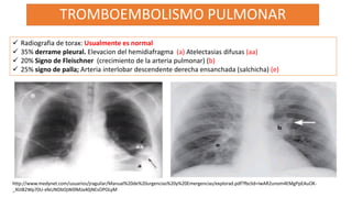 RADIOGRAFIAS EN URGENCIAS Y EMERGENCIAS | PDF