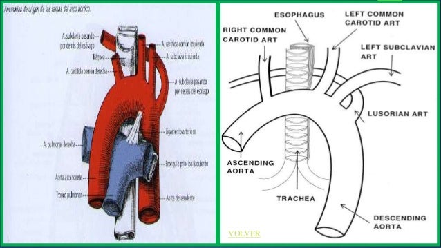 Exposición anatomia subclavia