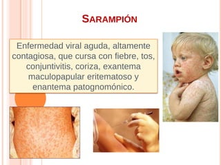 eruptivas de la infancia | PDF